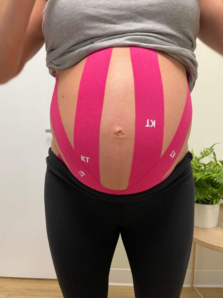 Best Kinesiology Tape For Pregnancy: Top 4 Picks