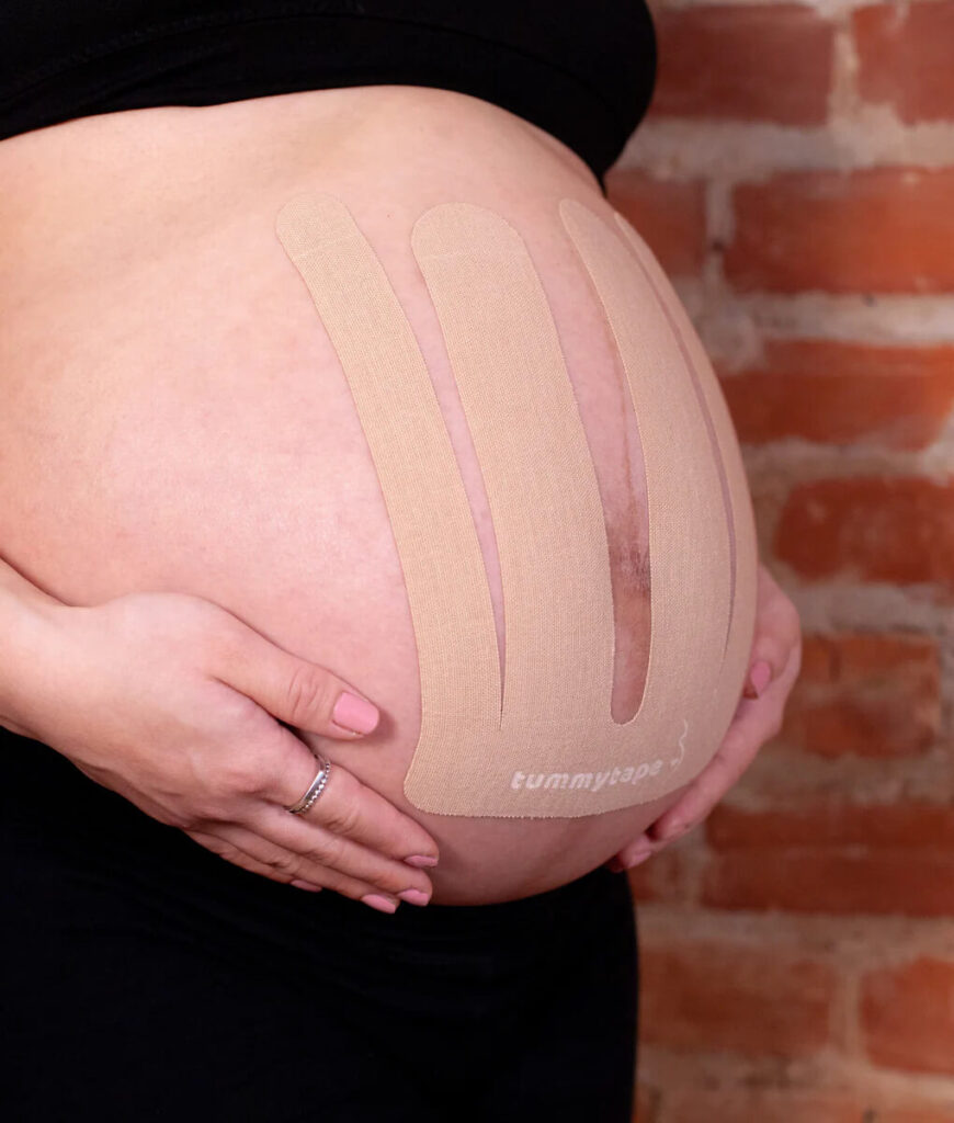 Tummy Tape: Your Pregnancy Companion